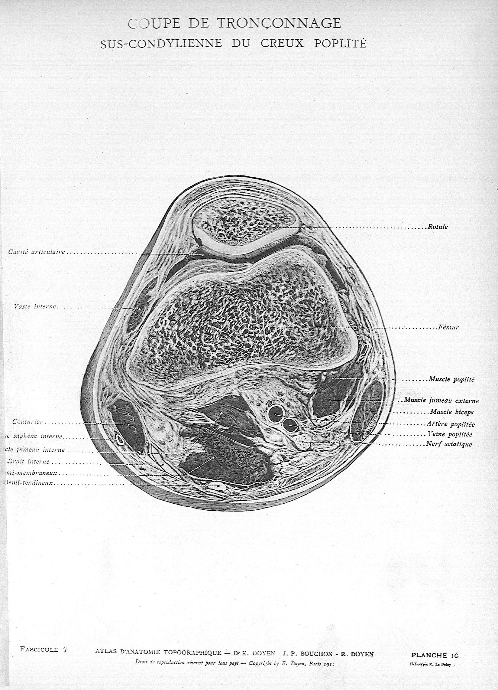 Banque d'images et de portraits — BIU Santé, Université Paris Cité